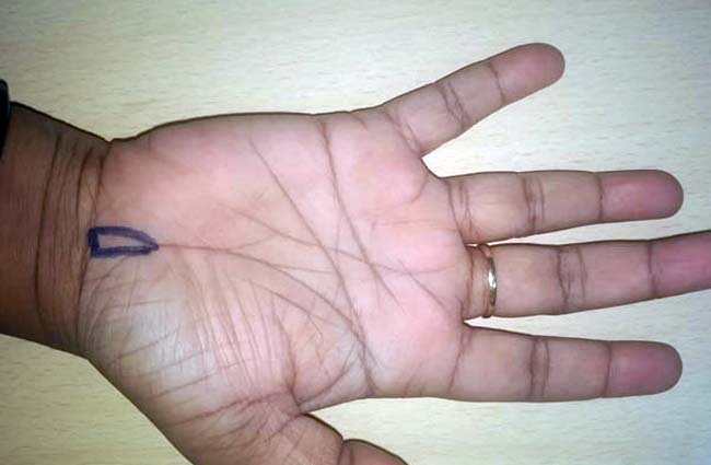 നിങ്ങളുടെ കൈയ്യിൽ ഇതുപോലെ മത്സ്യ ചിഹ്നം ഉണ്ടോ? എങ്കിൽ അറിഞ്ഞോളൂ നിങ്ങ ...